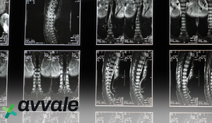 Avvale | Case Study | Cerapedics